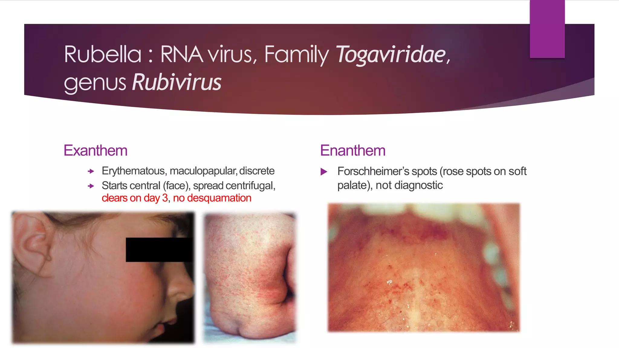 Approach to child – fever with rash | PDF