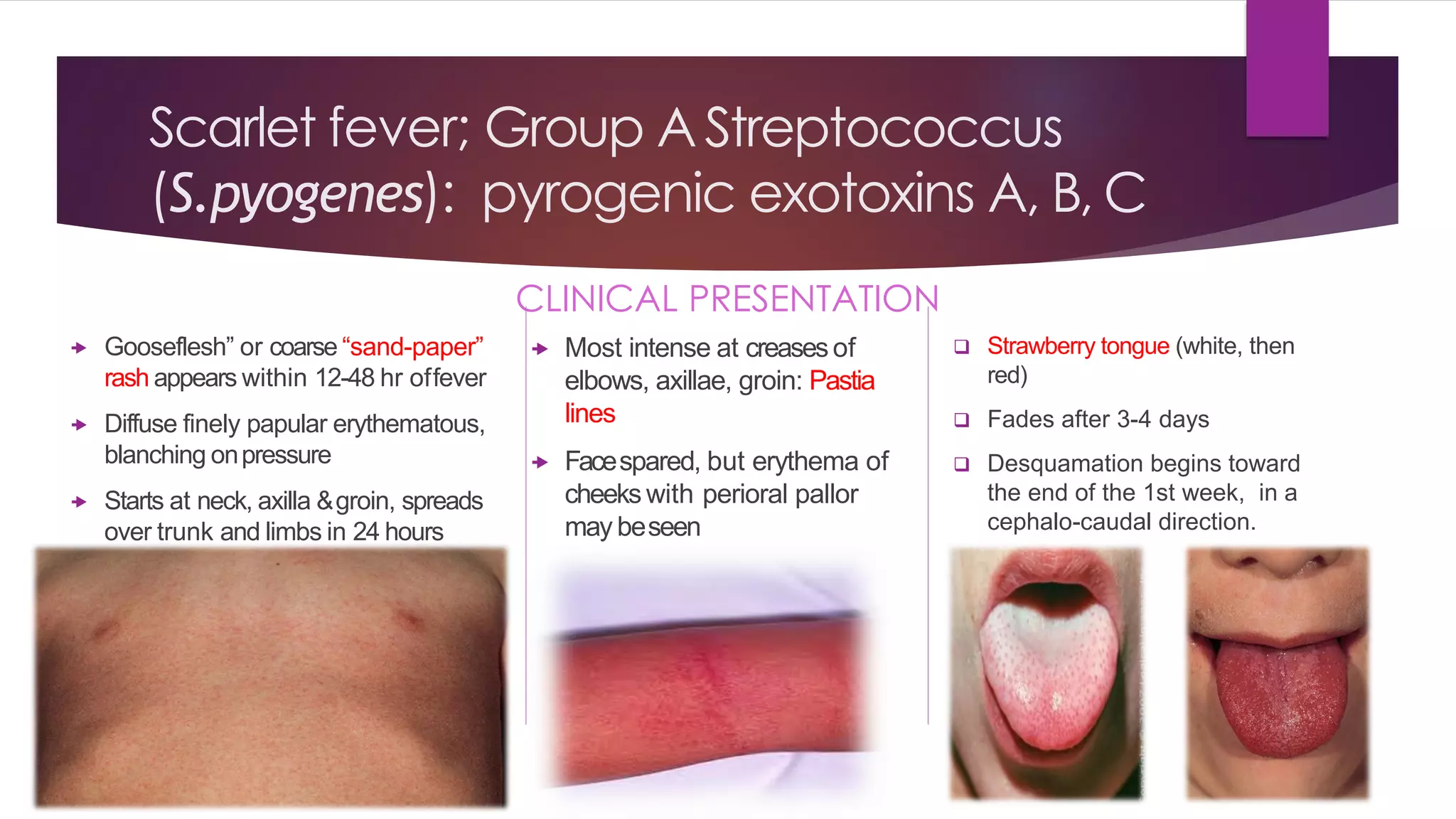 Approach to child – fever with rash | PDF