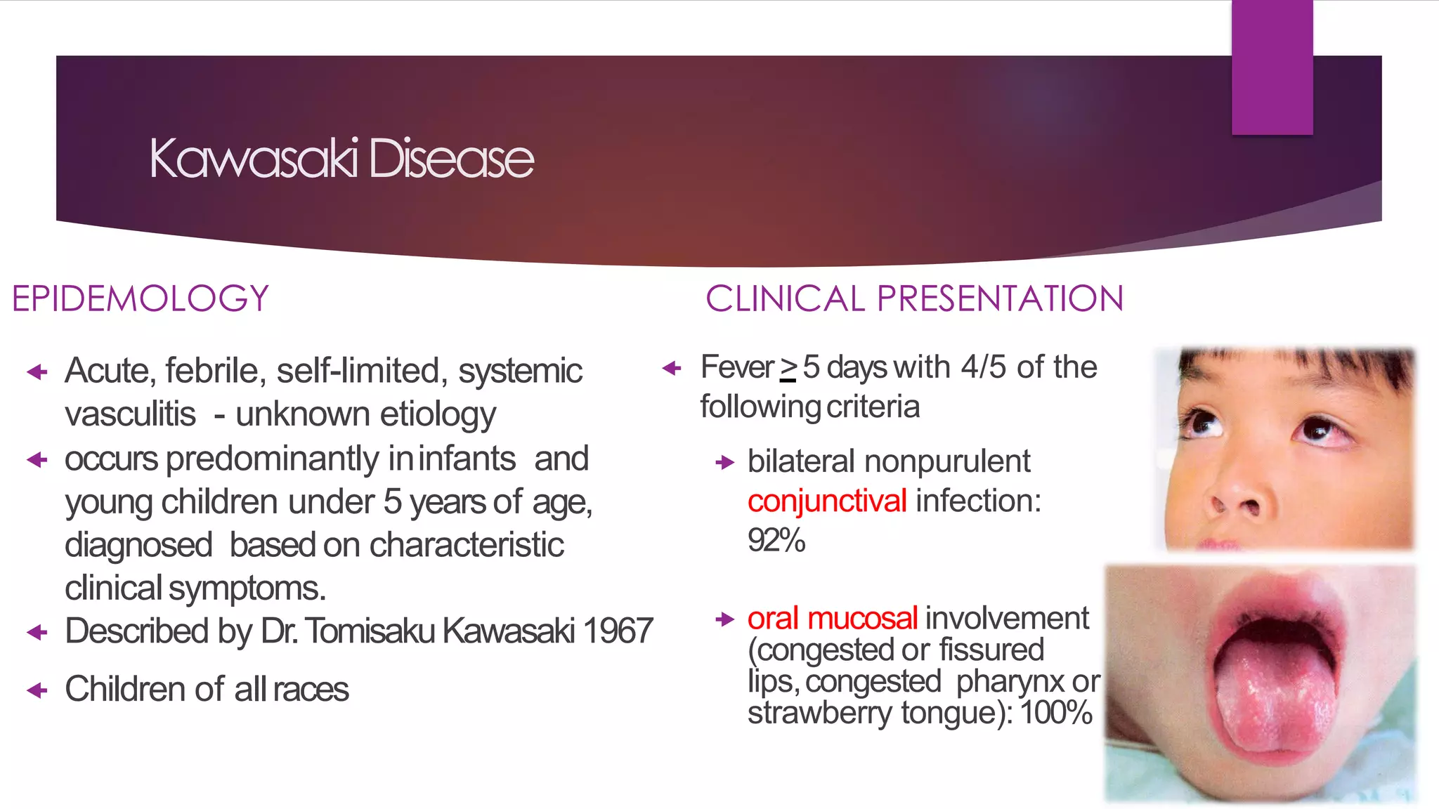 Approach to child – fever with rash | PDF