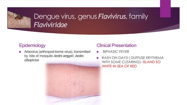 Approach to child – fever with rash | PDF