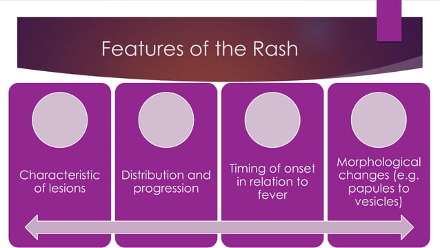 Approach to child – fever with rash | PDF