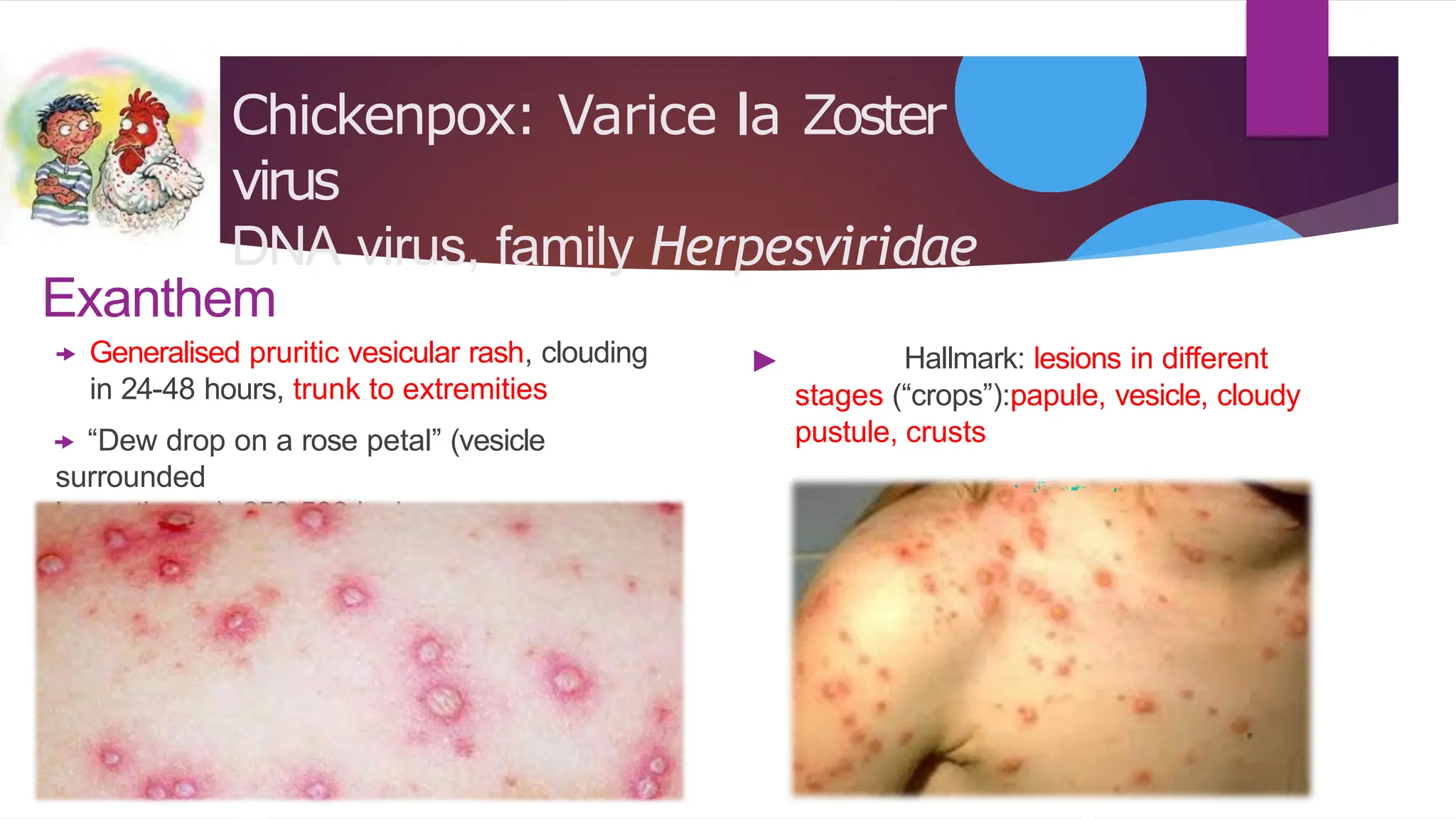 approachtochildfeverwithrash-.pptx important clinical picture | PPTX