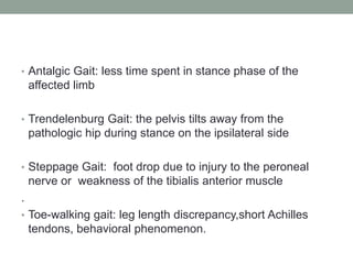 Approach to child with a limp | PPTX
