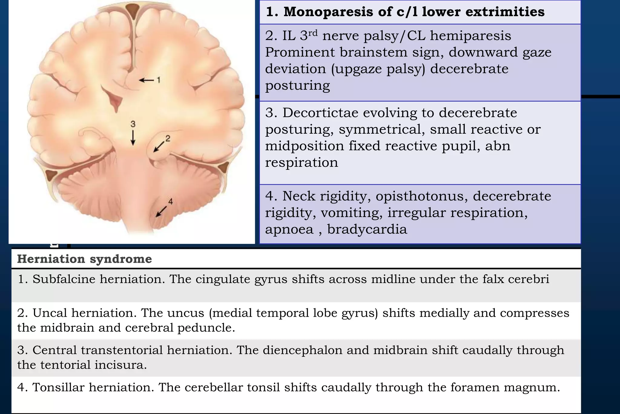 Approach to child with coma | PPTX