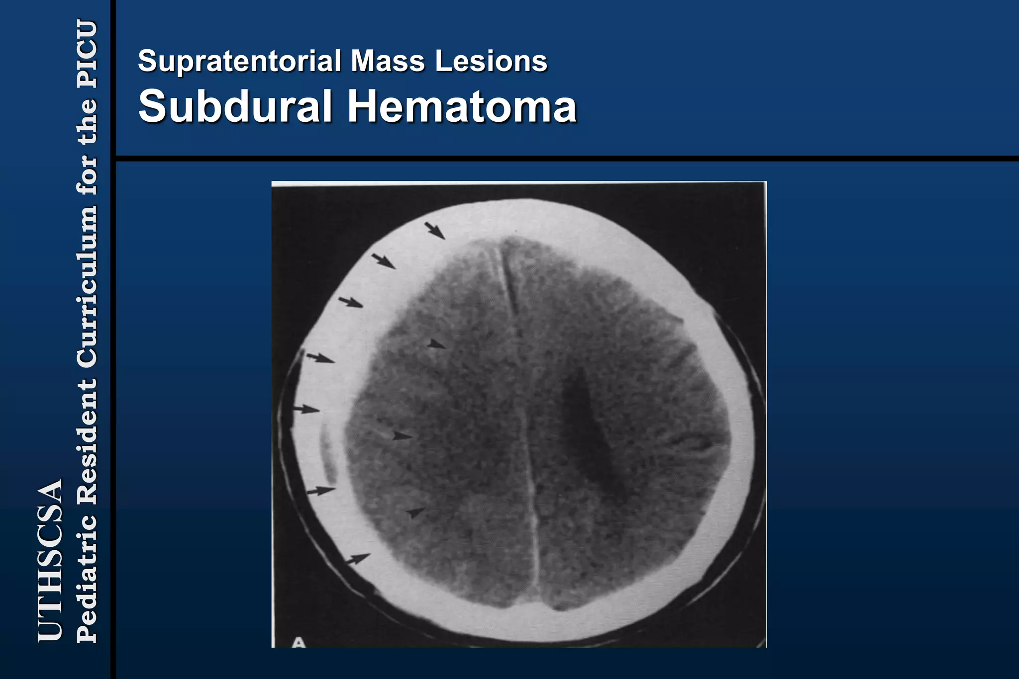 Approach to child with coma | PPTX | Brain and Nervous System Disorders ...