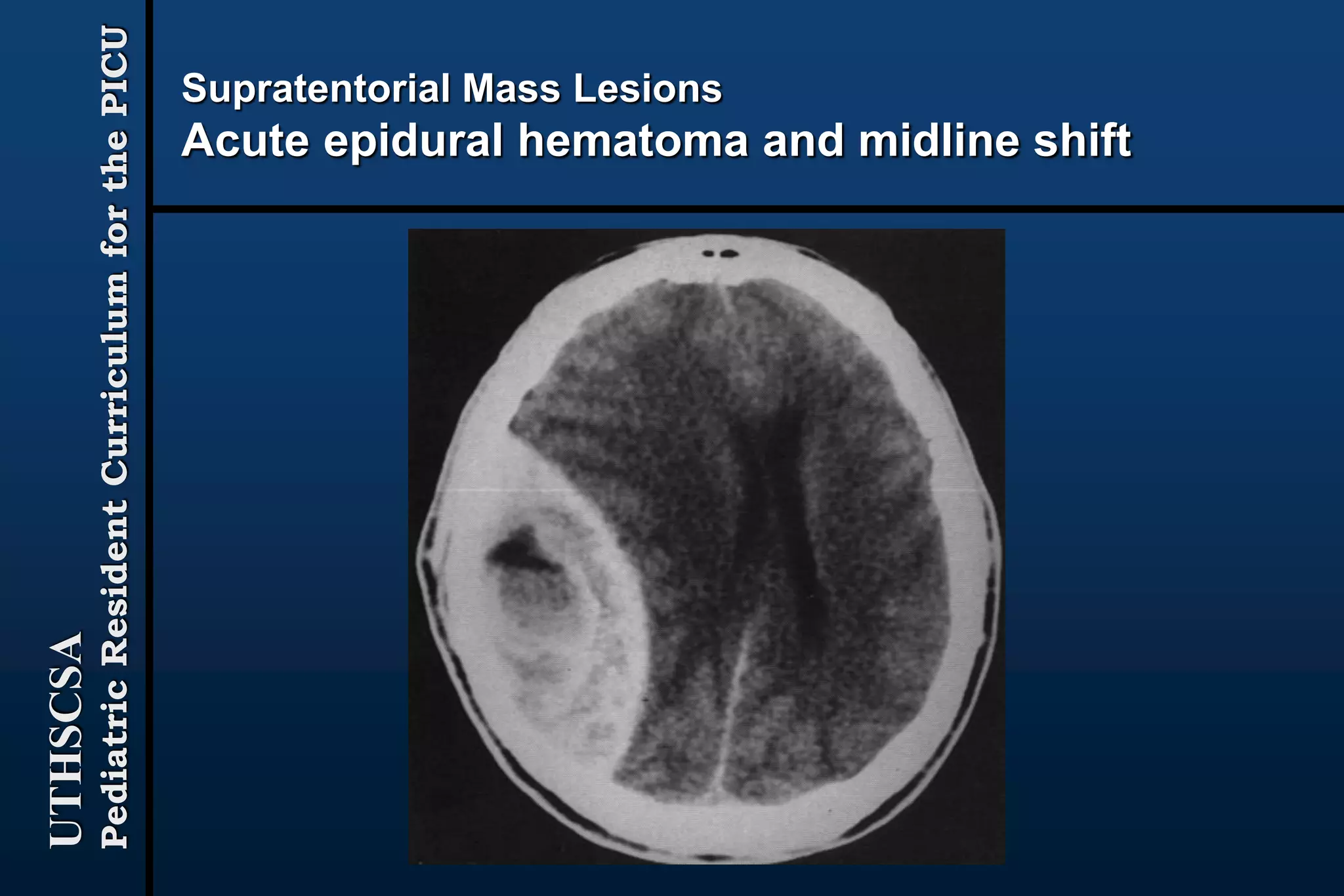 Approach to child with coma | PPTX | Brain and Nervous System Disorders ...