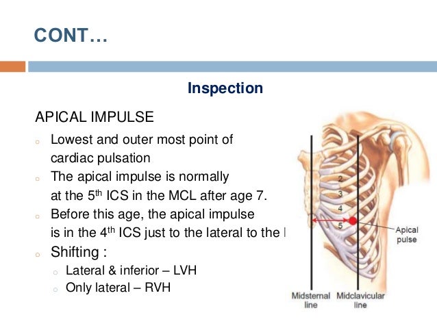 Approach to child with congenital heart disease