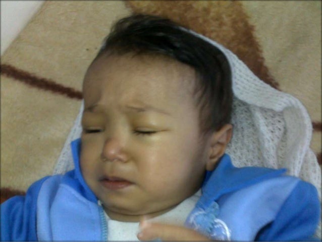 Approach to child with generalized edema