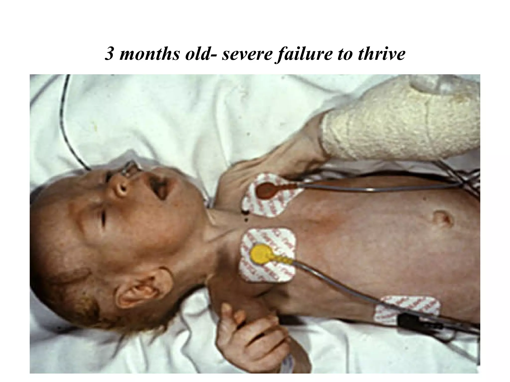 Approach to child with heart disease | PPT