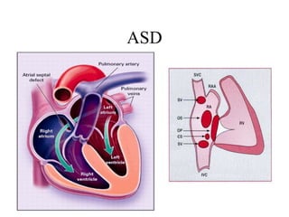 Approach to child with heart disease | PPT