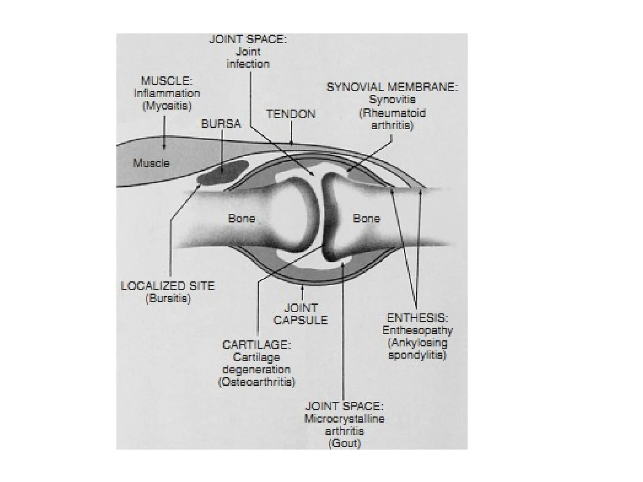 Approach to a child with joint pain hhhh | PPTX
