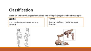 APPROACH TO CHILD WITH LOWER LIMB WEAKNESS.pptx