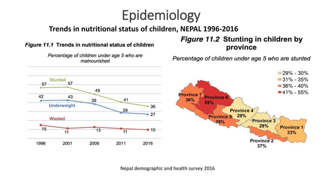 Approach to child with malnutrition | PPTX | Children\'s Health ...