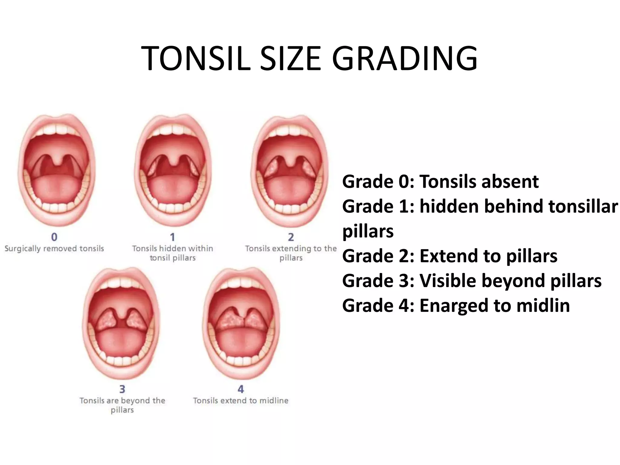 Approach to child with mouth breathing and snoring | PPTX