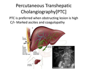 Approac h to cholestatic jaundice | PPTX