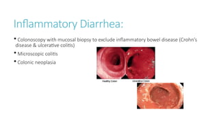 Approach to Chronic Diarrhea presentation | PPTX