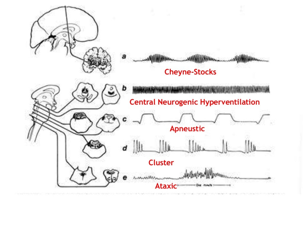 Approach to the Comatose patient