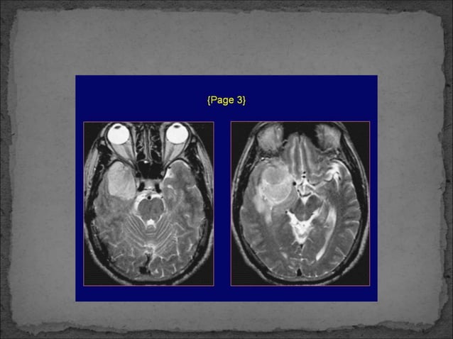 Approach to Coma.ppt