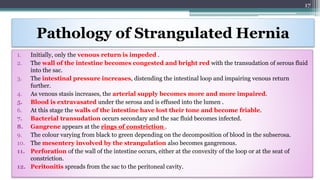 Approach to complicated Hernia | PPTX