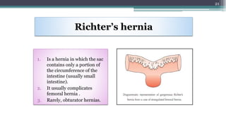 Approach to complicated Hernia | PPT