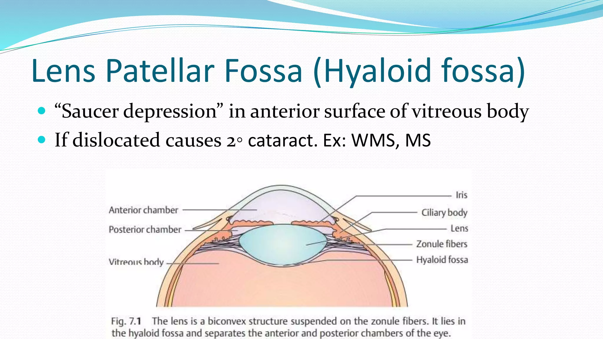 approach to congenital cataract.pptx