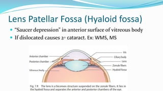 approach to congenital cataract.pptx