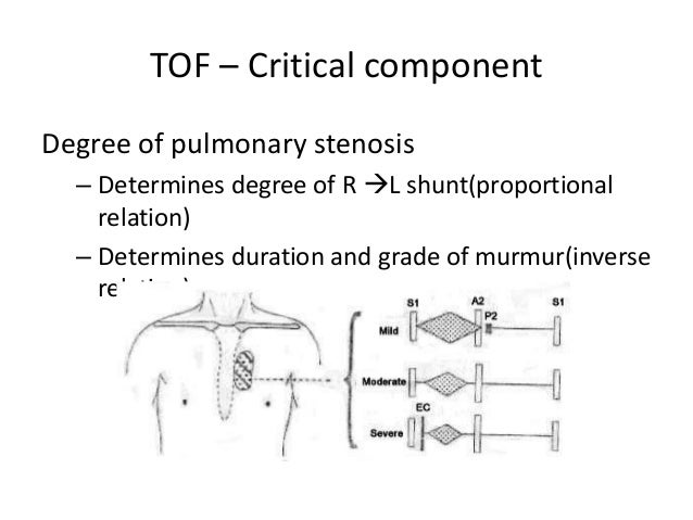 Approach to congenital cyanotic heart diseases