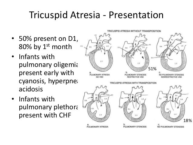 Approach to congenital cyanotic heart diseases