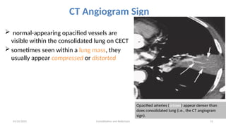 Approach to consolidation and atelectasis .pptx