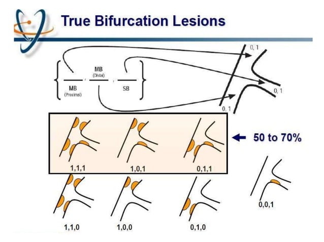 APPROACH TO CORONARY BIFURCATION LESIONS-DR SANTHOSH 2 (1).pptx