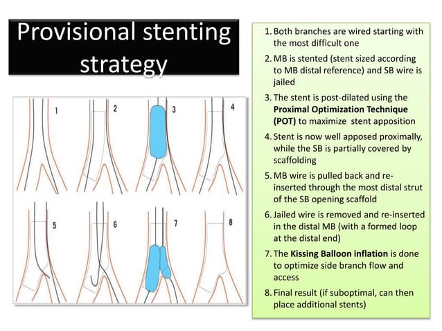 APPROACH TO CORONARY BIFURCATION LESIONS-DR SANTHOSH 2 (1).pptx
