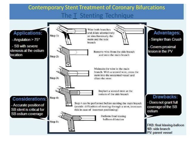 APPROACH TO CORONARY BIFURCATION LESIONS-DR SANTHOSH 2 (1).pptx