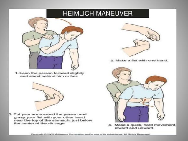 Approach to cough | PPT