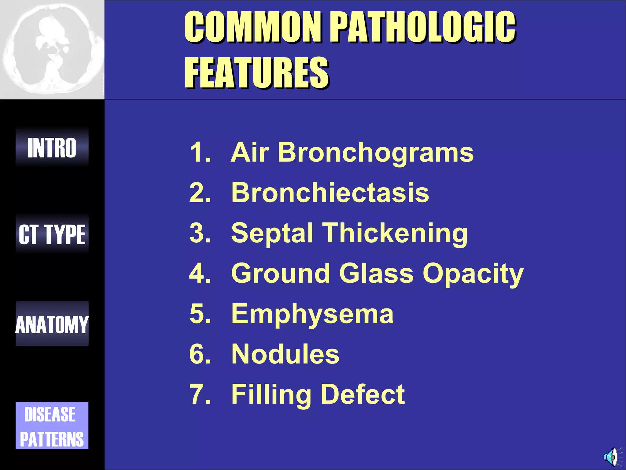 Approach to ct chest 578 | PPT