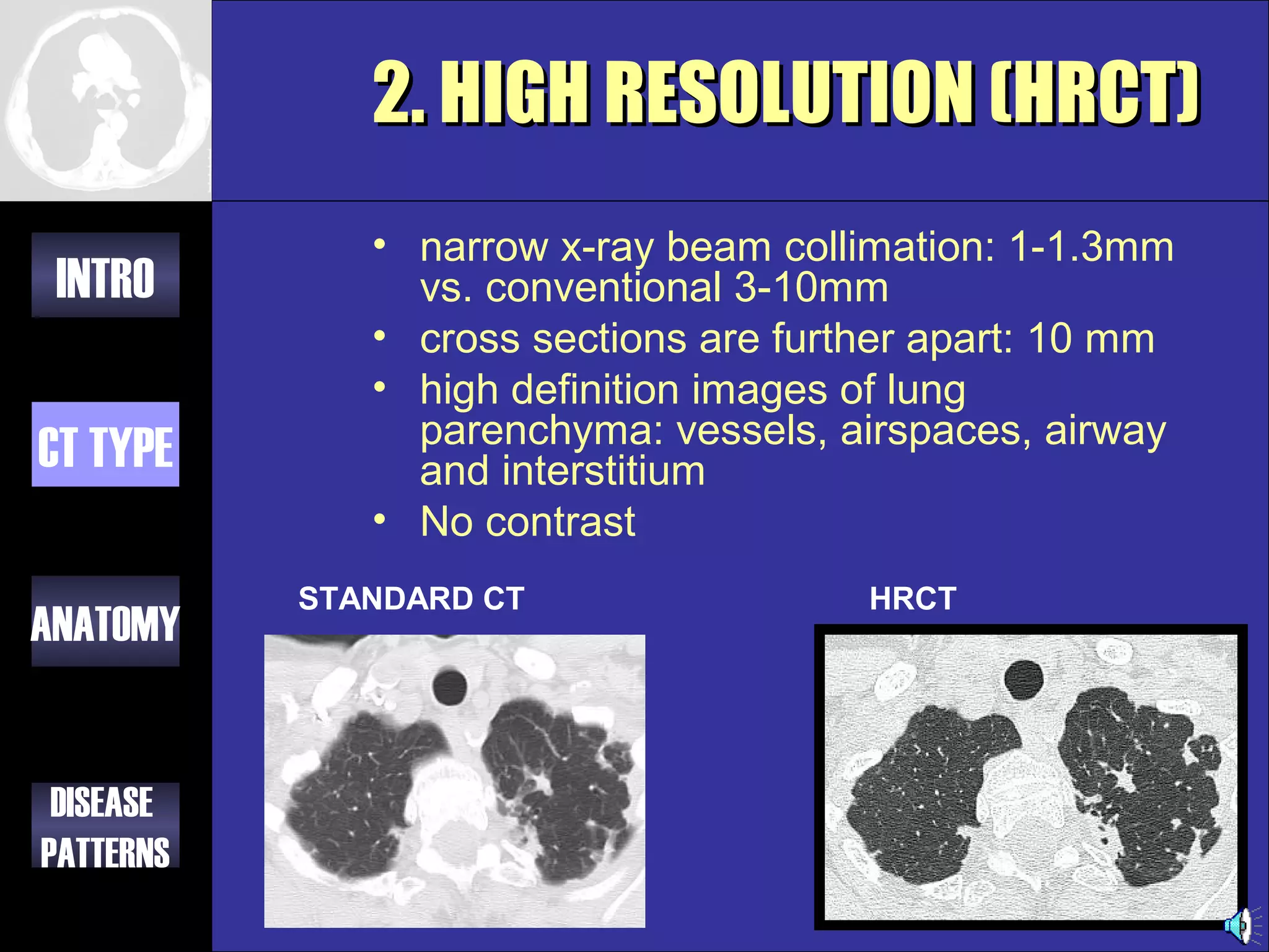 Approach to ct chest 578 | PPT | Lung and Respiratory Health | Diseases ...