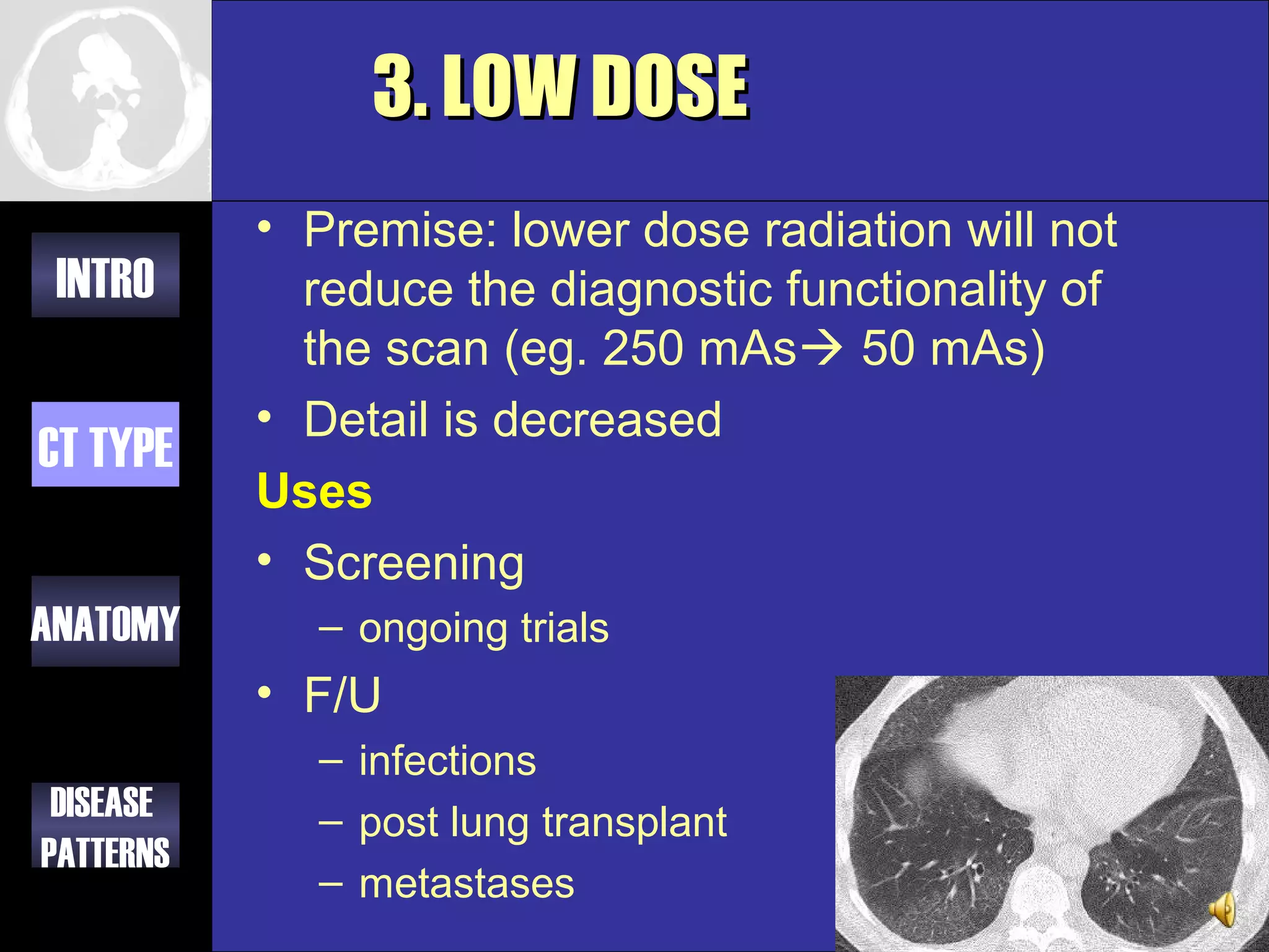 Approach to ct chest 578 | PPT