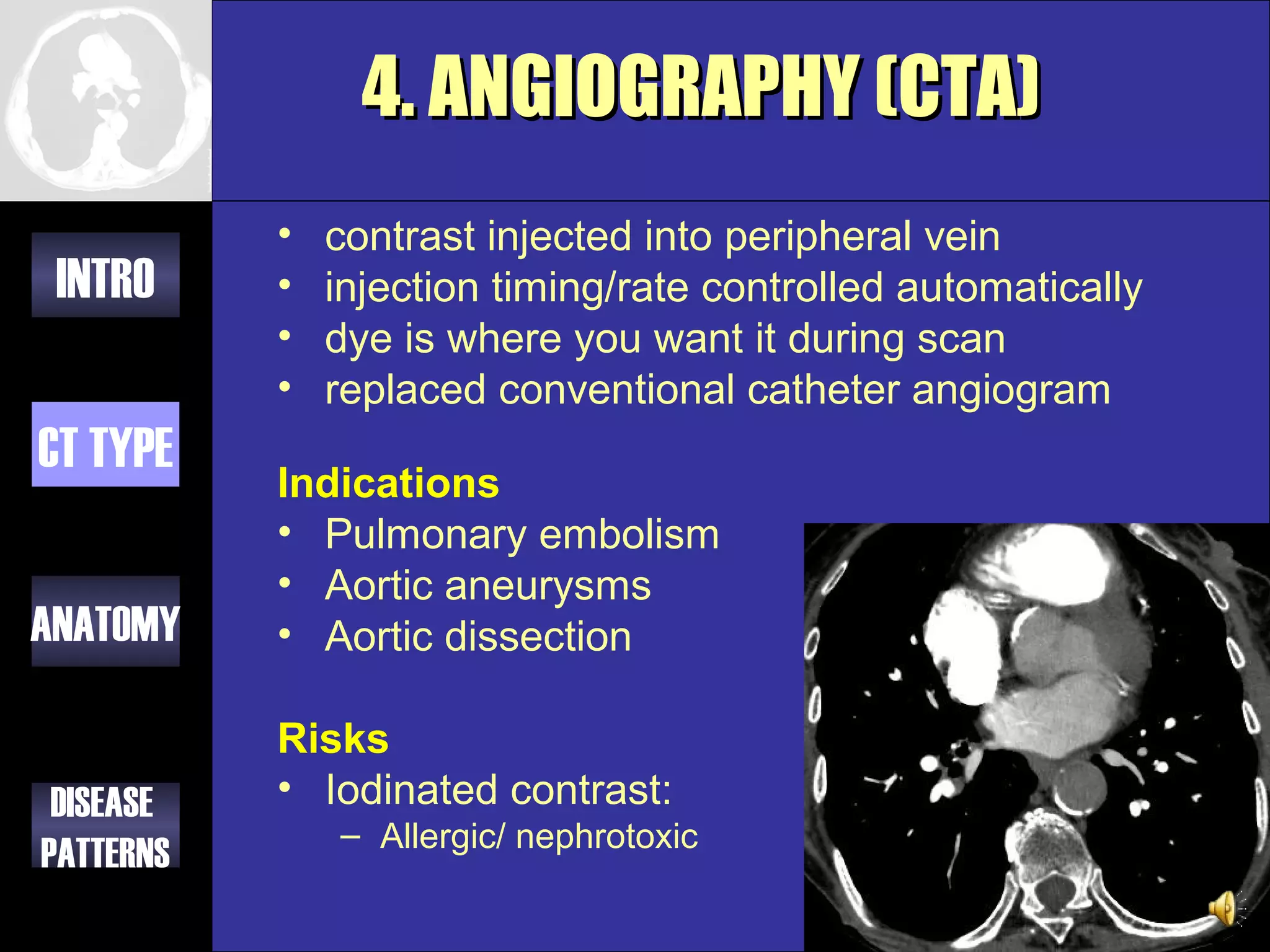 Approach to ct chest 578 | PPT