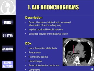 Approach to ct chest 578 | PPT | Lung and Respiratory Health | Diseases ...