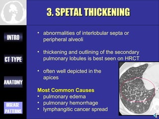 Approach to ct chest 578 | PPT