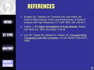 Approach to ct chest 578 | PPT
