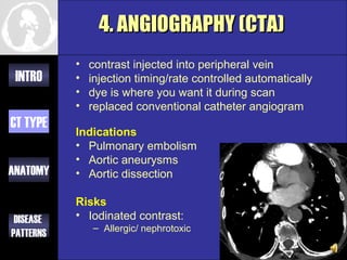 Approach to ct chest 578 | PPT