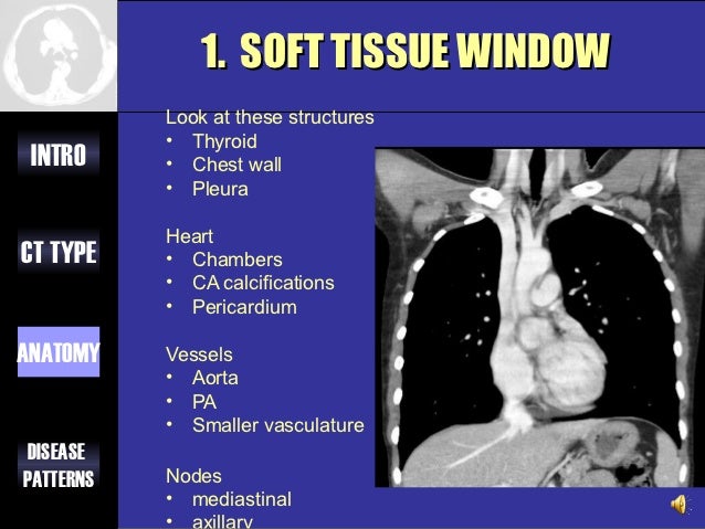 Approach to ct chest 578