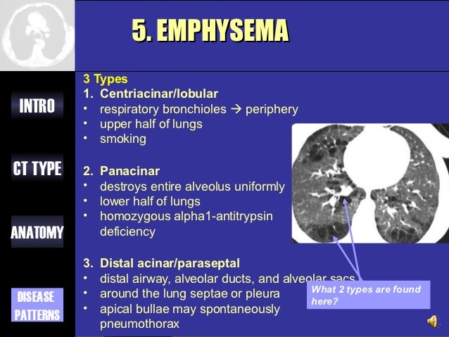 Approach to ct chest 578