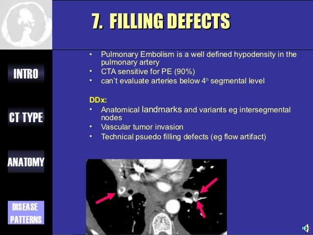Approach to ct chest 578