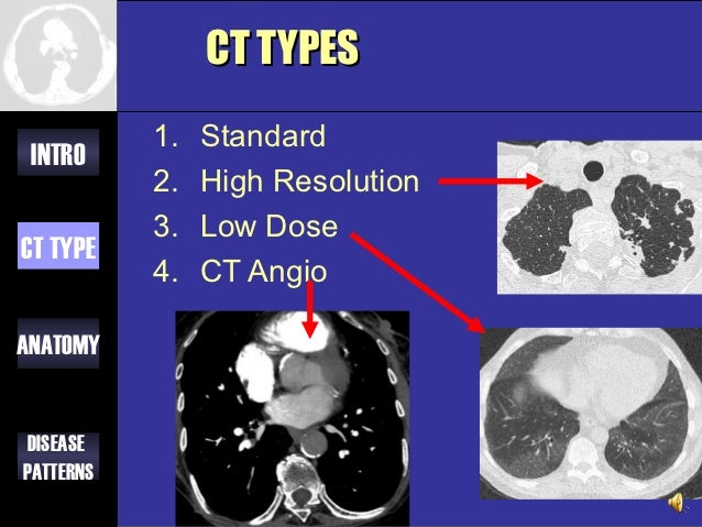 Approach to ct chest 578