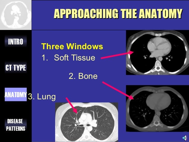 Approach to ct chest 578