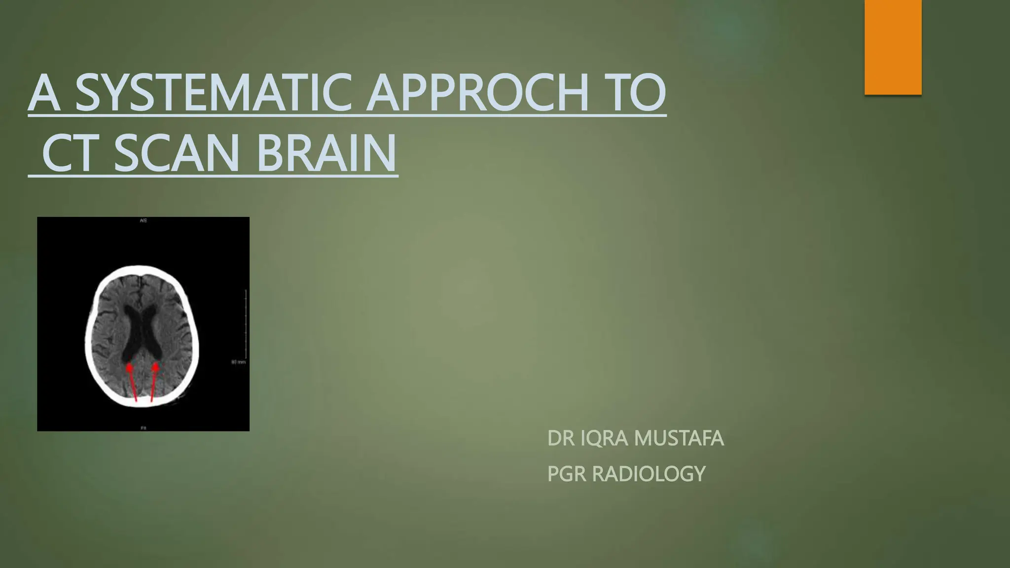Approach to CT scan brain.pptx Uuuuuu | PPTX | Death, Injury, or Military Conflict | Sensitive ...