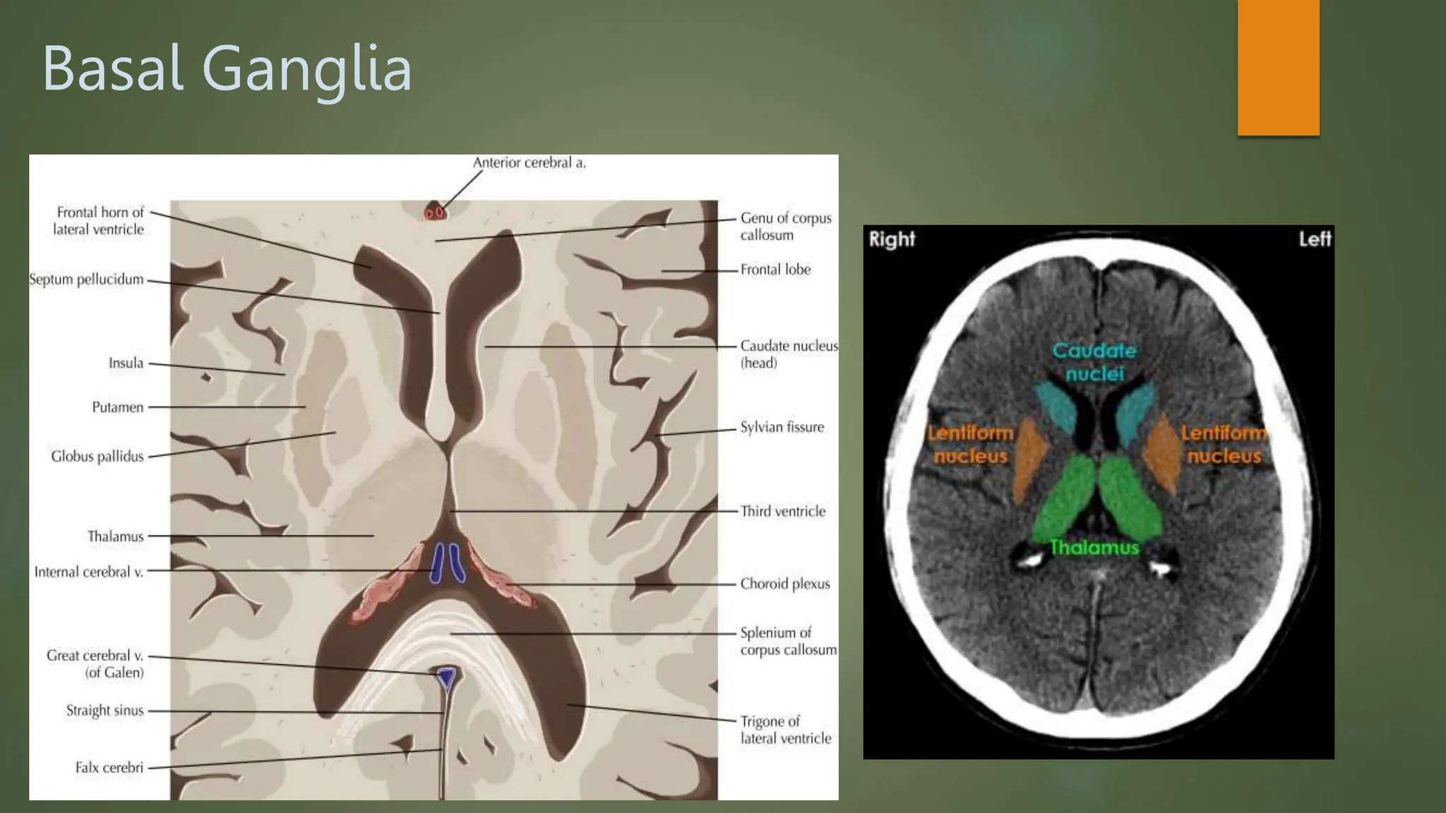 Approach to CT scan brain.pptx Uuuuuu | PPTX | Death, Injury, or Military Conflict | Sensitive ...