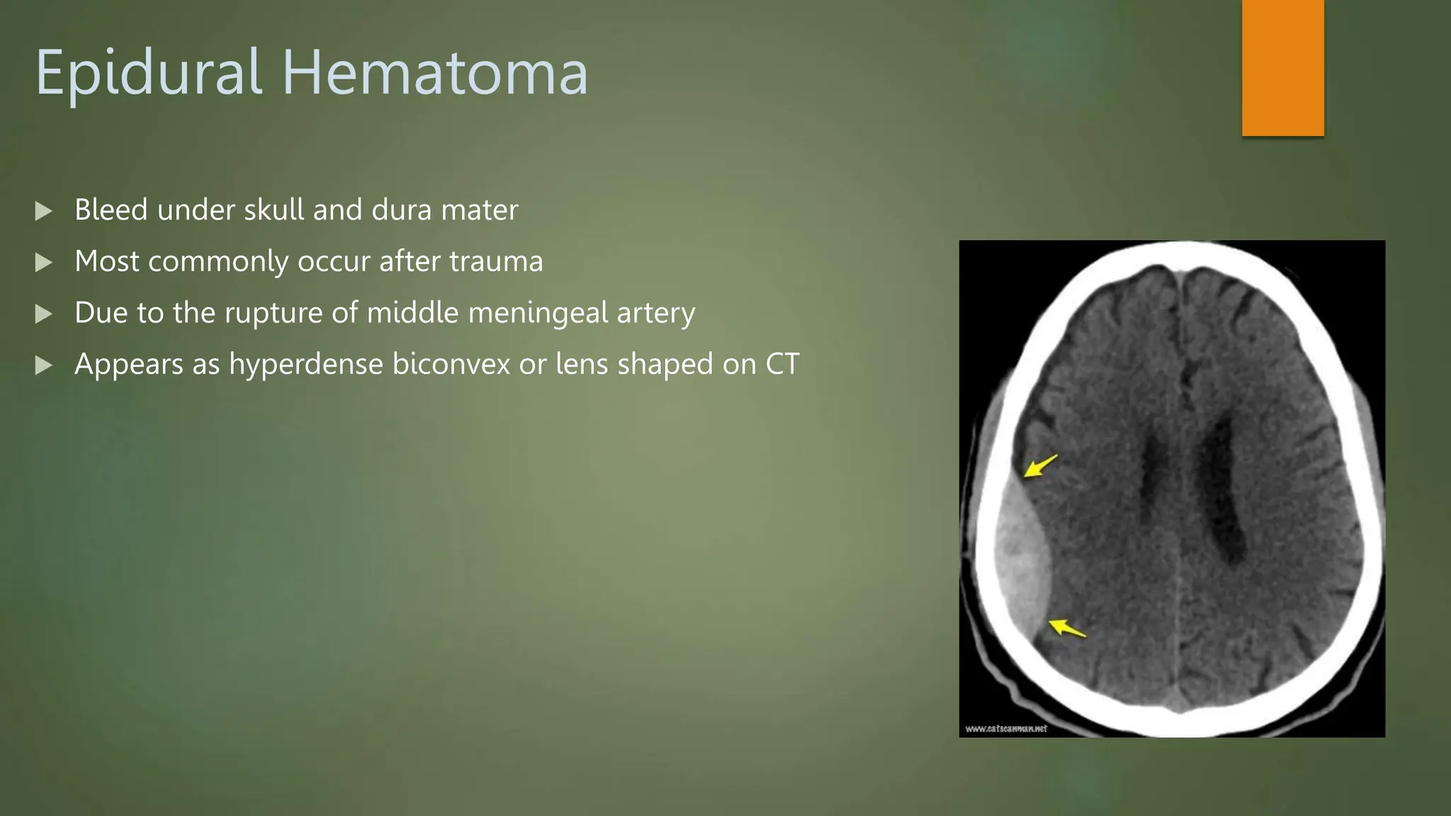 Approach to CT scan brain.pptx Uuuuuu | PPTX | Death, Injury, or Military Conflict | Sensitive ...