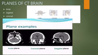 Approach to CT scan brain.pptx Uuuuuu | PPTX